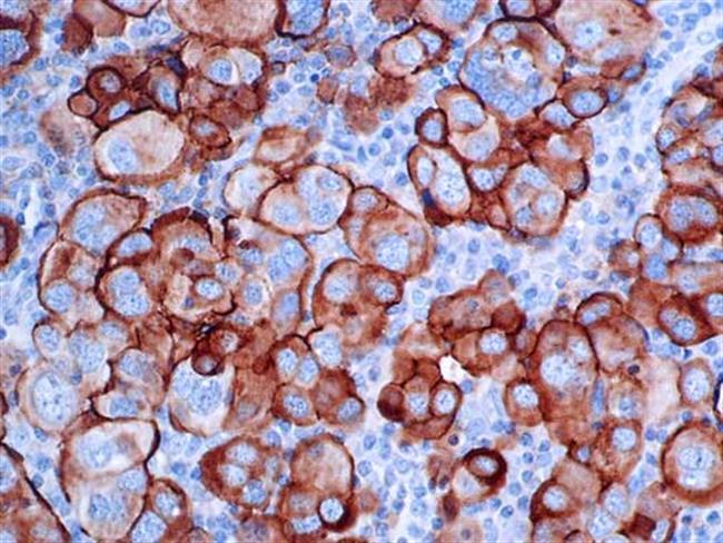 CA-125 (OC125), MMab – Bio SB Inc. Online Store