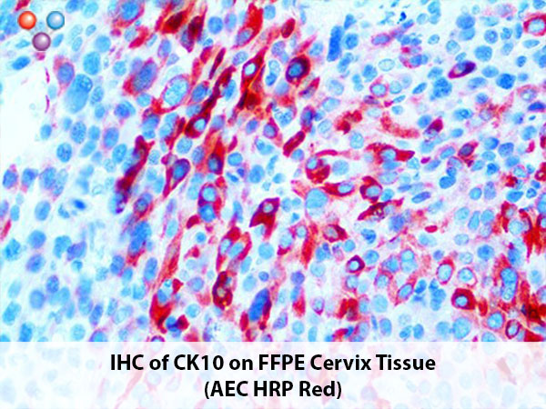 PolyDetector Liquid AEC HRP Ready-To-Use – Bio SB Inc. Online Store