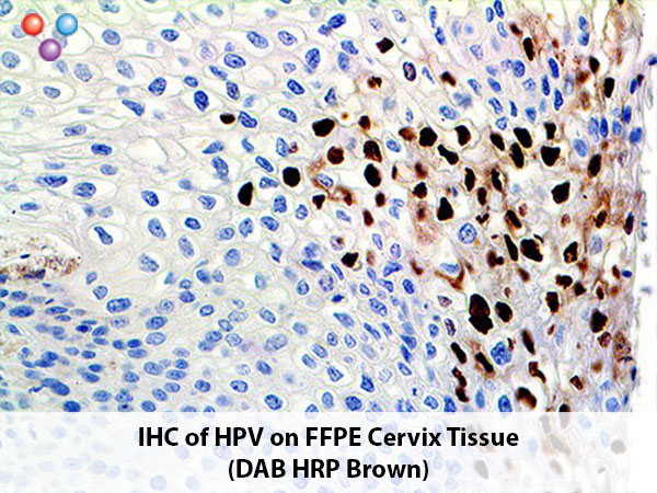 PolyDetector DAB HRP Brown Chromogen – Bio SB Inc. Online Store