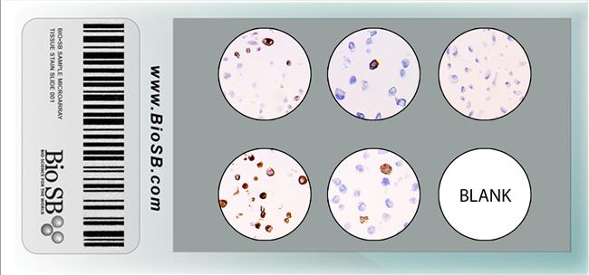 5-Core Melanoma Cell Line Microarray – Bio SB Inc. Online Store
