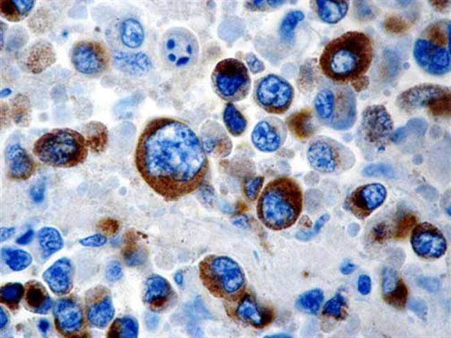 Melanosome HMB45 (HMB-45), MMab – Bio SB Inc. Online Store