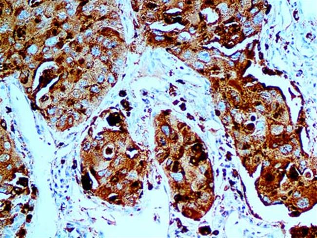 Napsin A (BSB-112), MMab – Bio SB Inc. Online Store