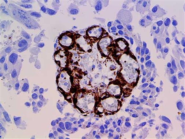 Osteonectin / SPARC (BSB-93), MMab – Bio SB Inc. Online Store