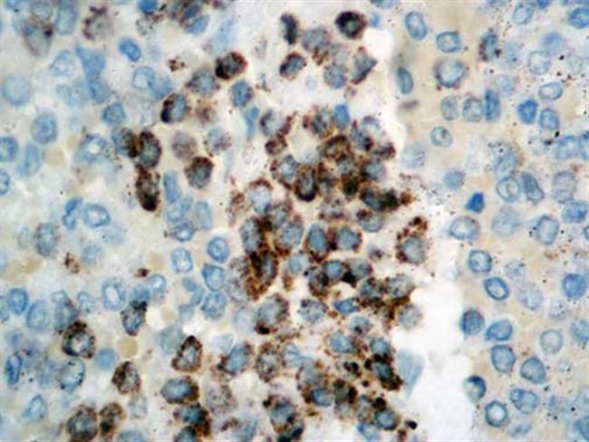 TRAcP (9C5), MMab – Bio SB Inc. Online Store