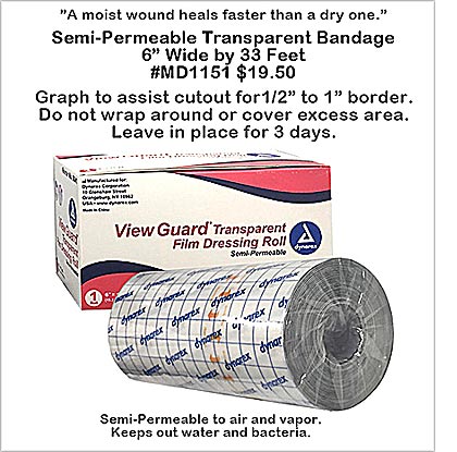 MD1151 Transparent Dressing